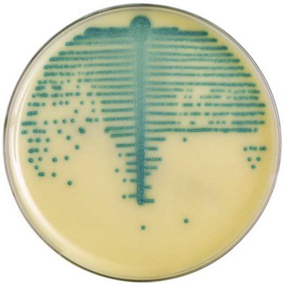 Chromogenic & High Medical Value Media | Pioneering Diagnostics